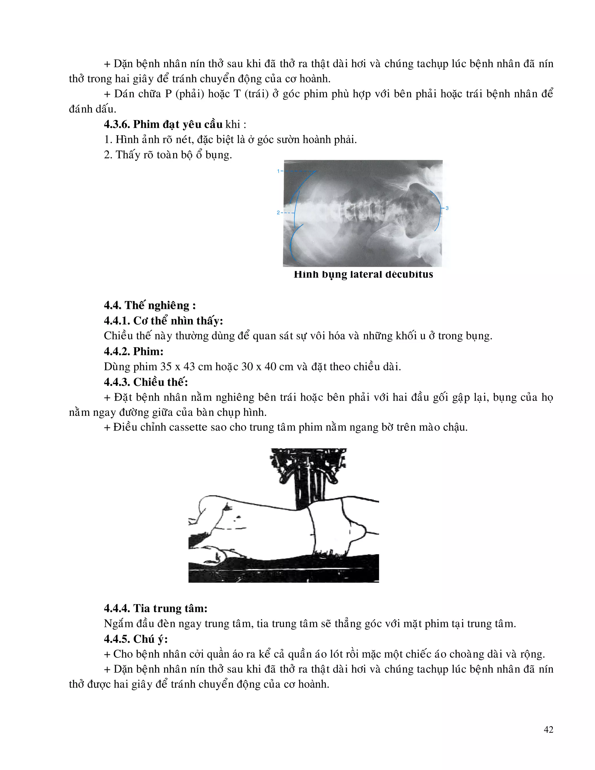 Xq ky thuat x quang quy uoc, nguyen doan cuong | PDF