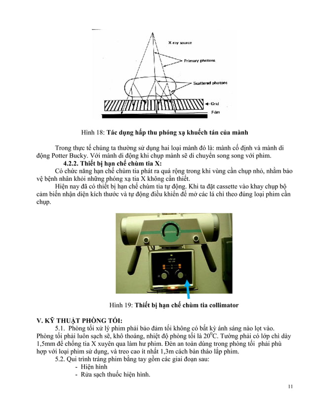 Xq ky thuat x quang quy uoc, nguyen doan cuong | PDF