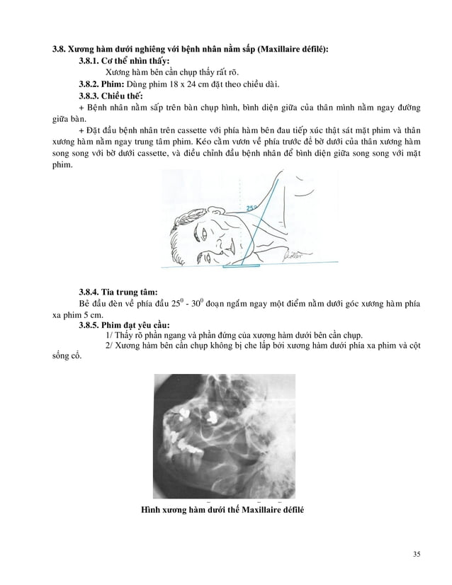 Xq ky thuat x quang quy uoc, nguyen doan cuong | PDF