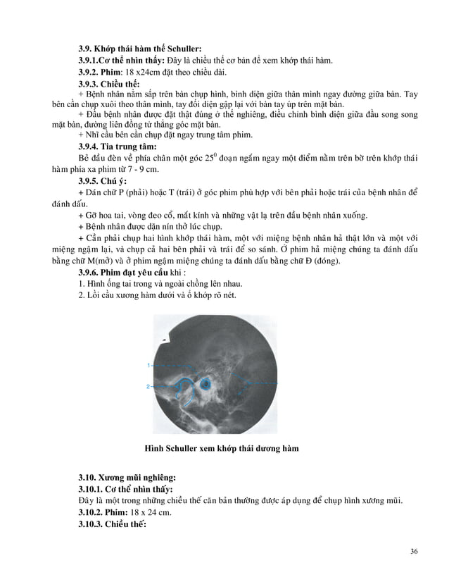 Xq ky thuat x quang quy uoc, nguyen doan cuong | PDF