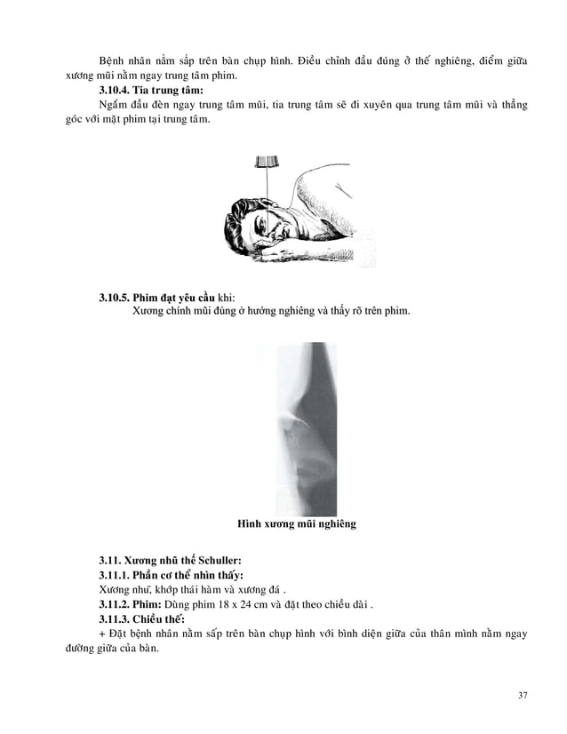 Xq ky thuat x quang quy uoc, nguyen doan cuong | PDF