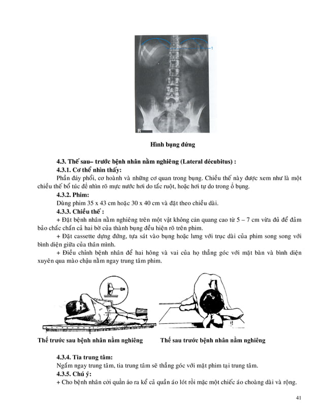 Xq ky thuat x quang quy uoc, nguyen doan cuong | PDF