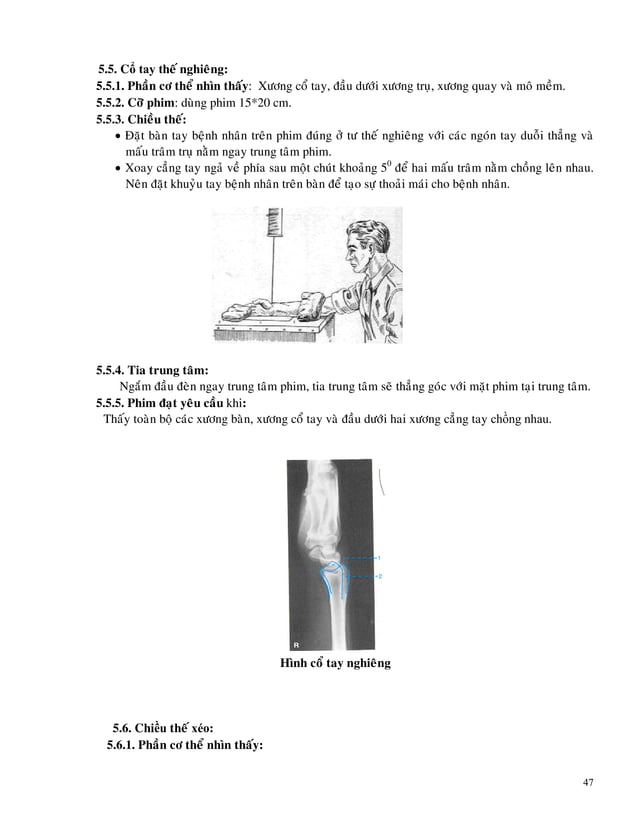 Xq ky thuat x quang quy uoc, nguyen doan cuong | PDF