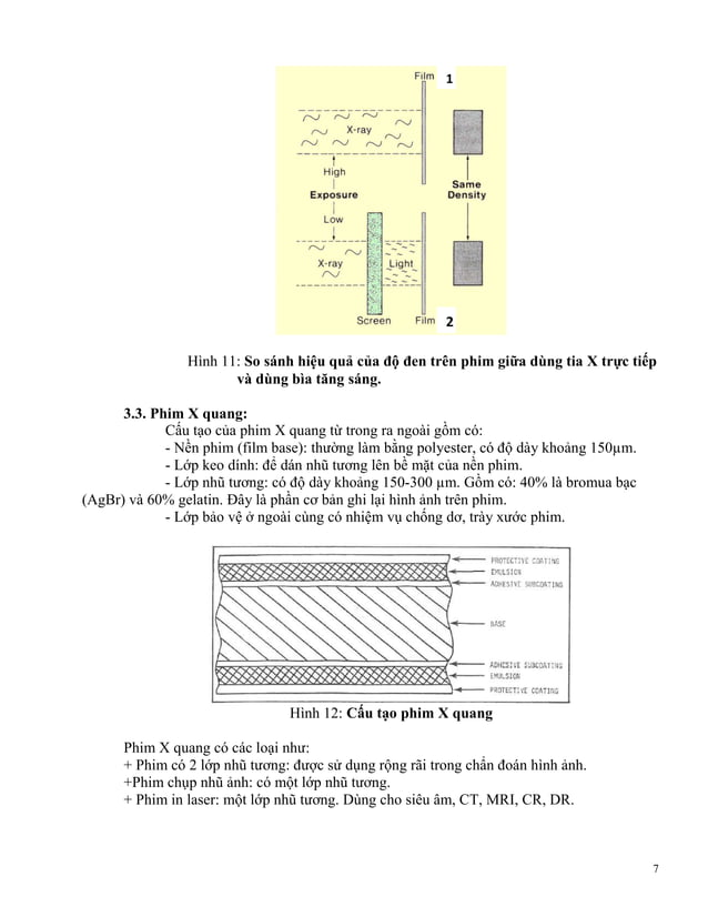 Xq ky thuat x quang quy uoc, nguyen doan cuong | PDF