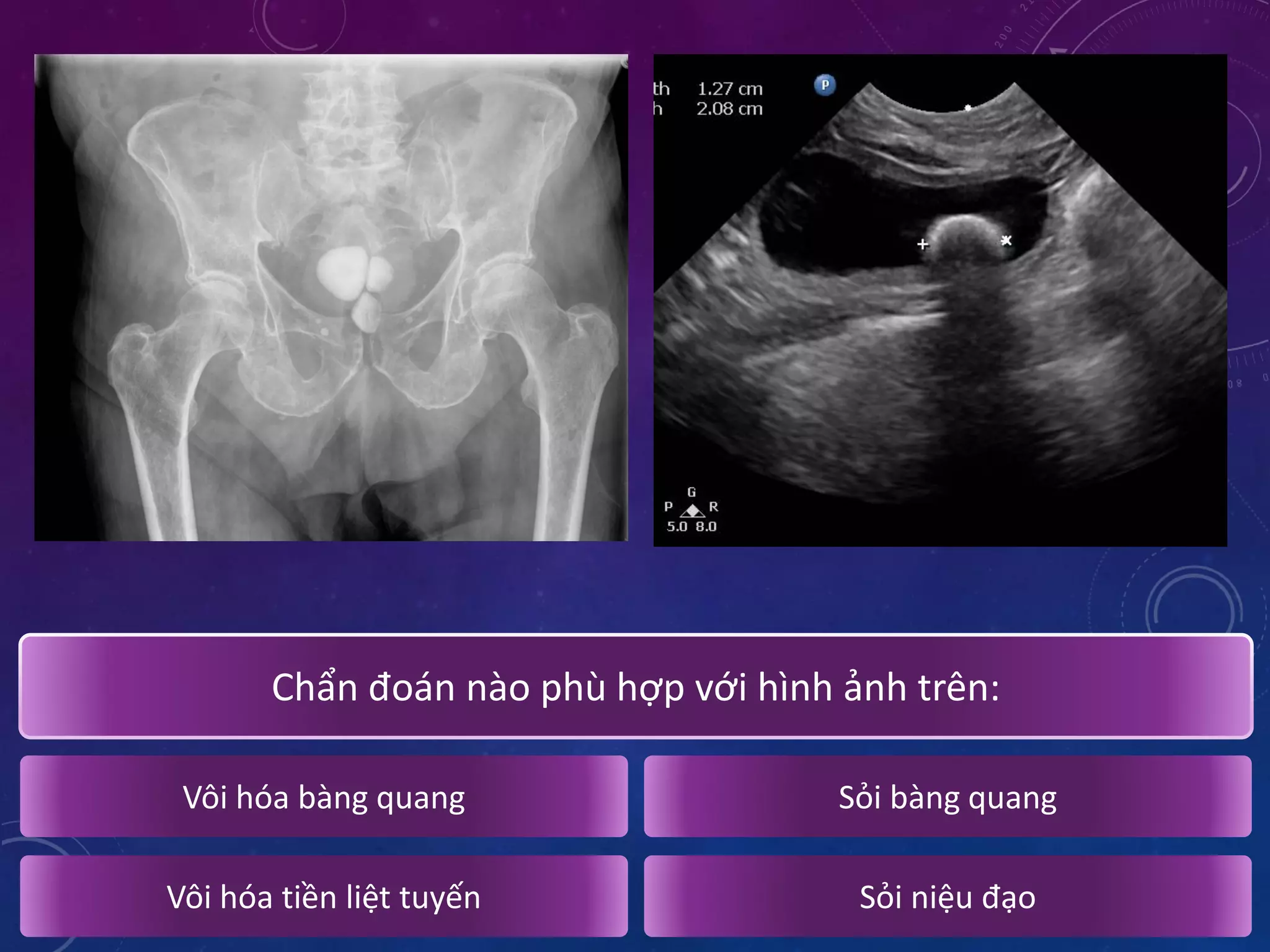 Thực hành Xquang hệ tiết niệu và cấp cứu bụng | PDF