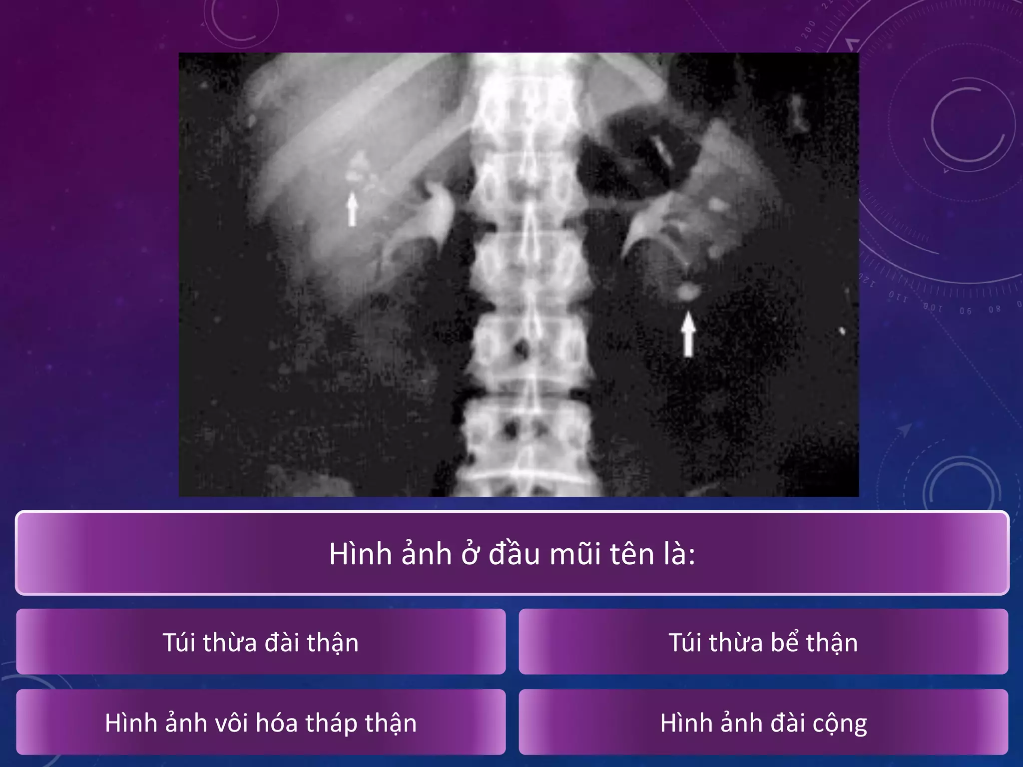 Thực hành Xquang hệ tiết niệu và cấp cứu bụng | PDF