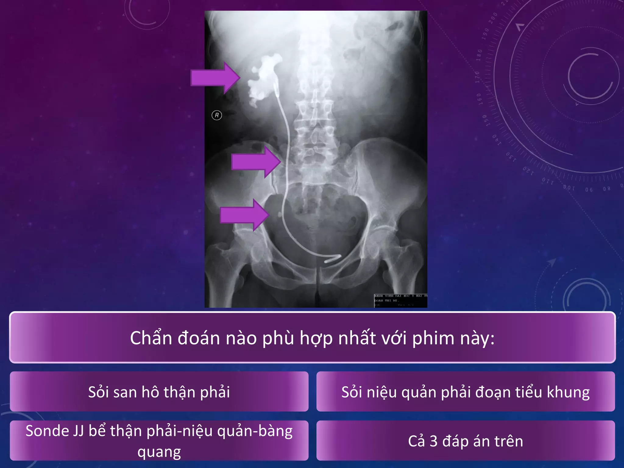 Thực hành Xquang hệ tiết niệu và cấp cứu bụng | PDF