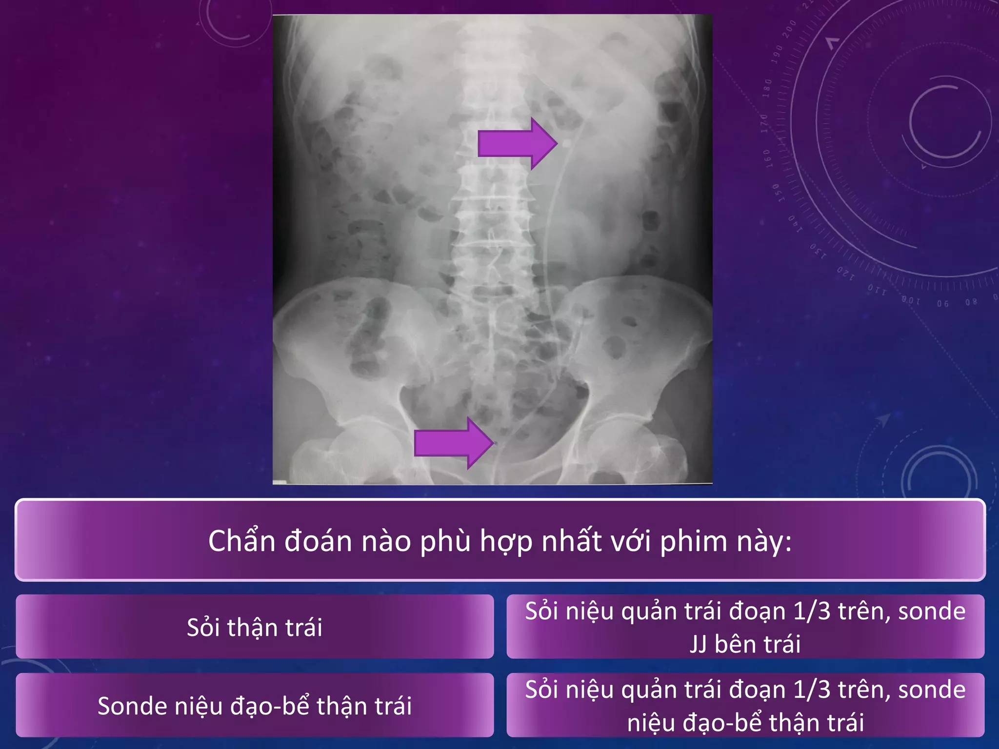 Thực hành Xquang hệ tiết niệu và cấp cứu bụng | PDF