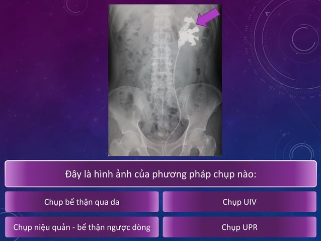 Thực hành Xquang hệ tiết niệu và cấp cứu bụng | PDF