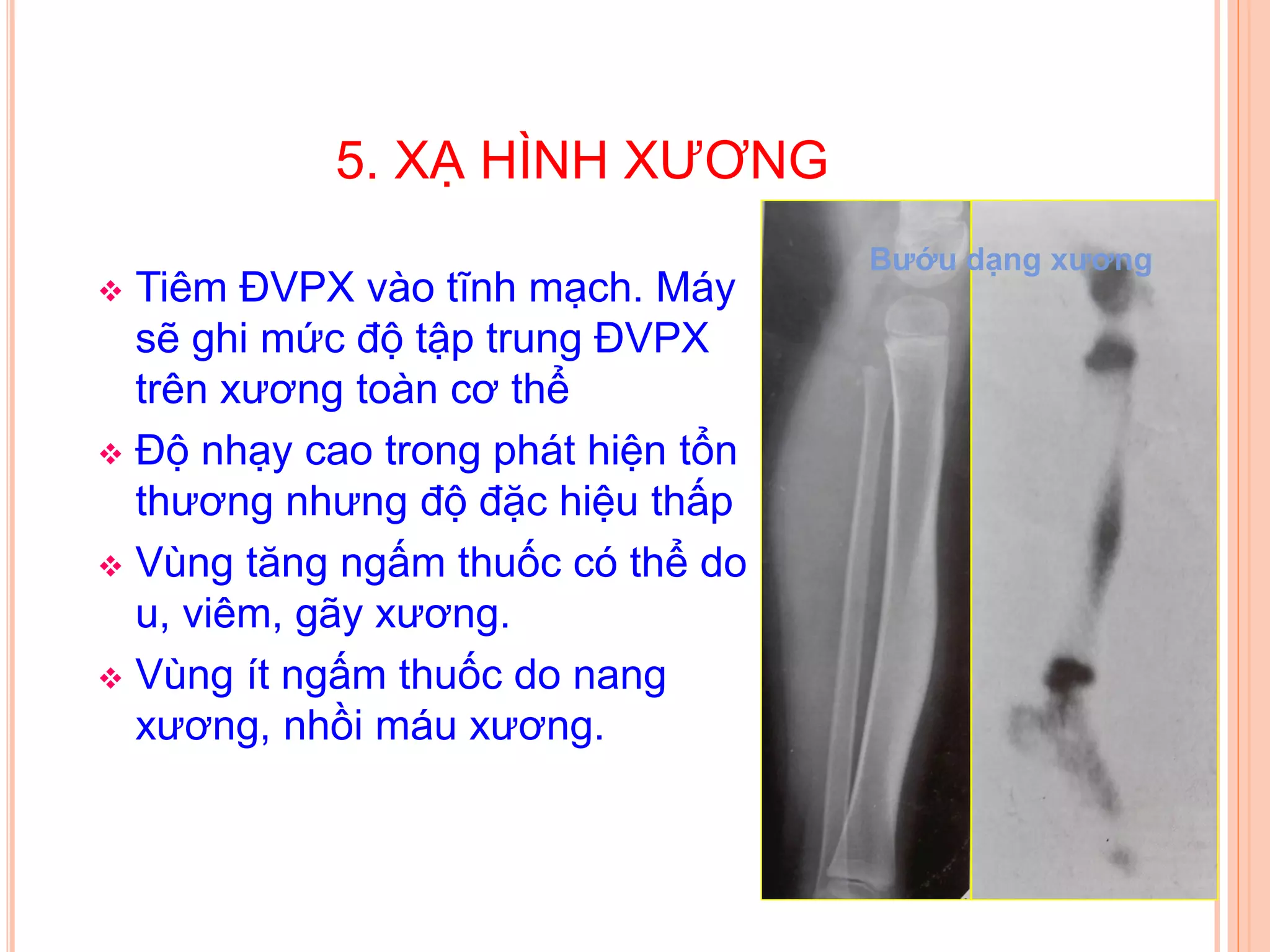 X quang xuong khop | PDF