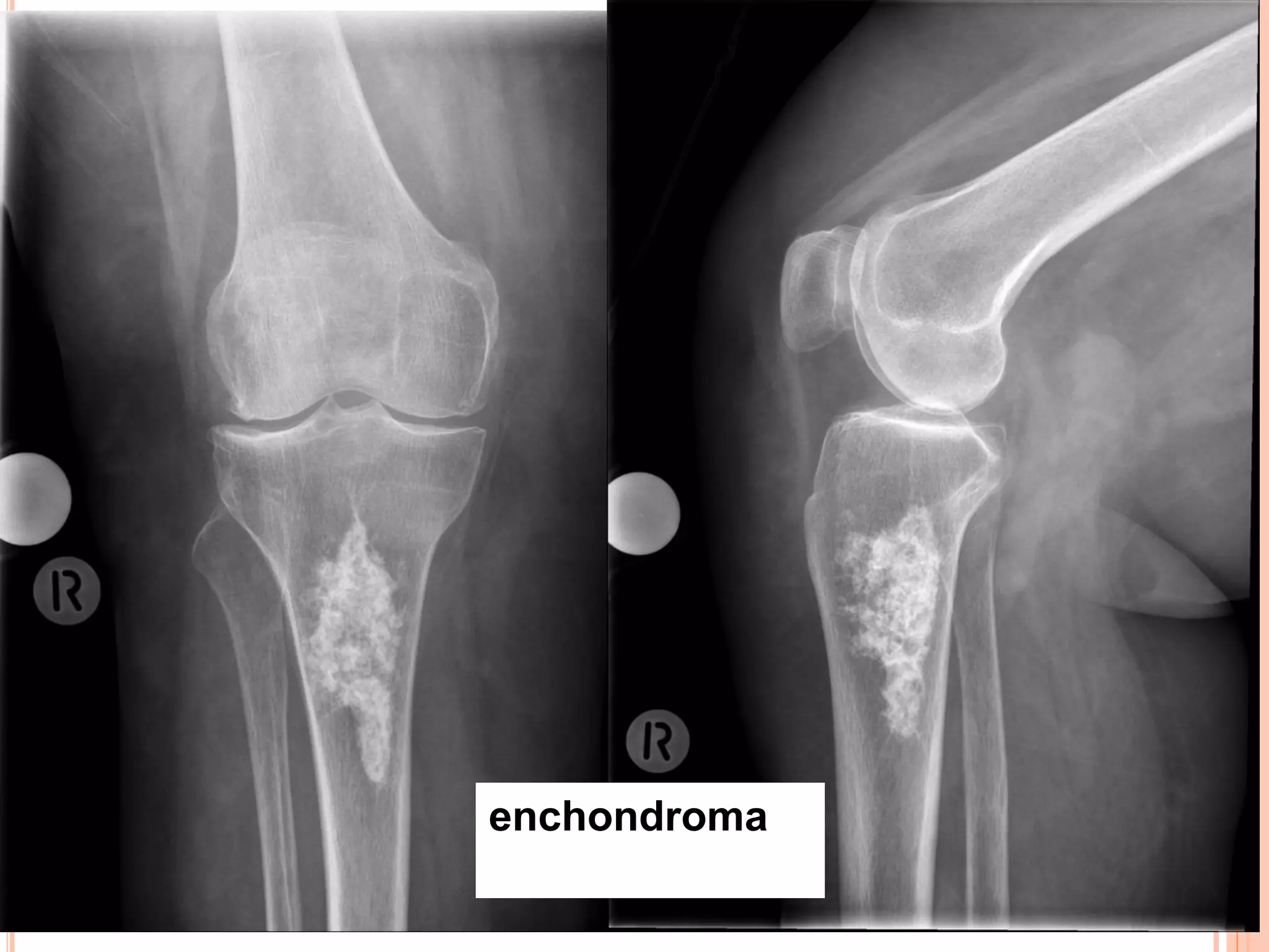 X quang xuong khop | PDF