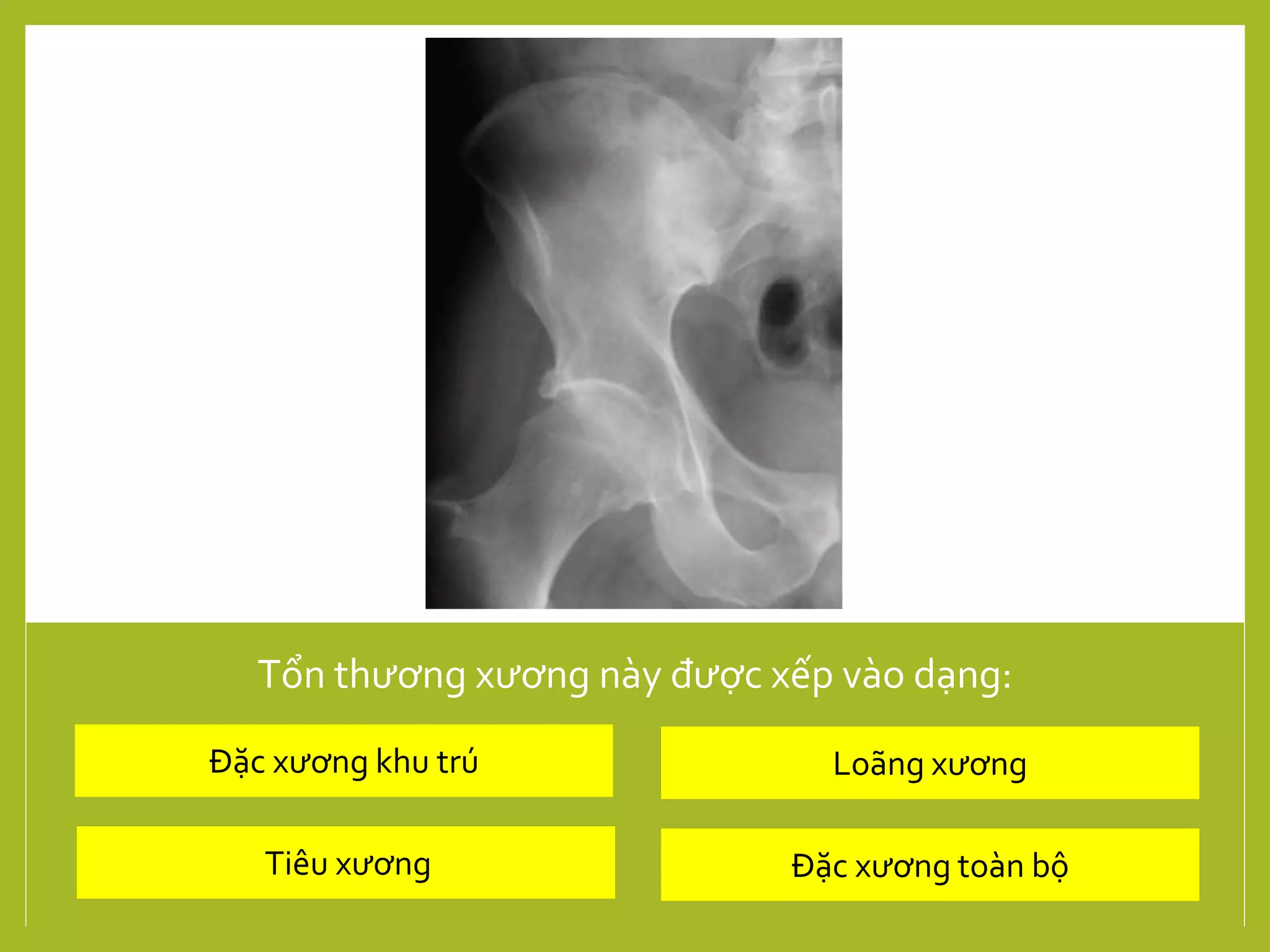 Thực hành xquang xương khớp | PDF