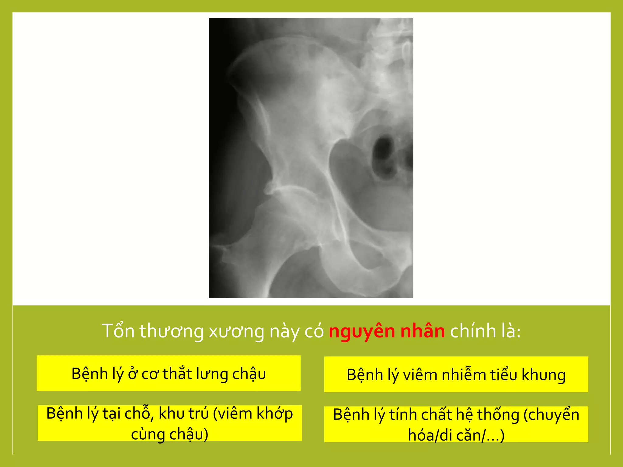 Thực hành xquang xương khớp | PDF
