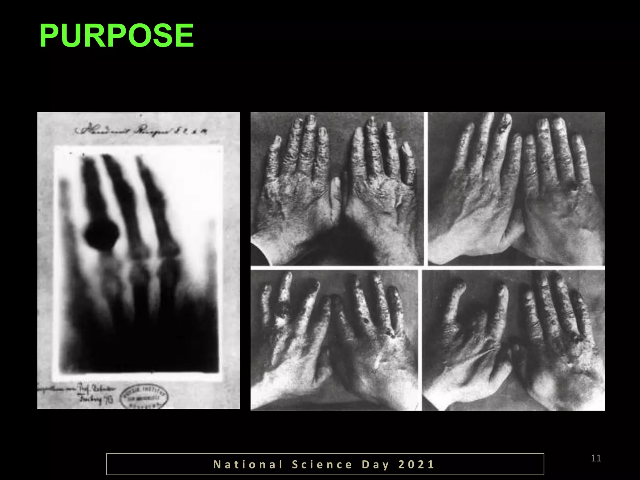 X radiation origin, purpose, procedure and risks | PPTX