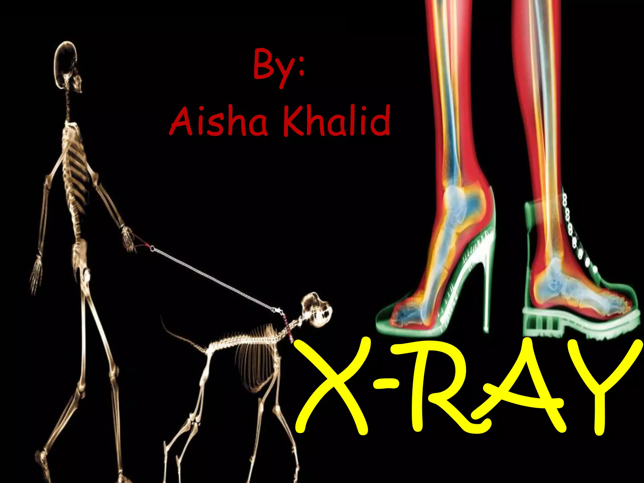 X-ray | PPTX