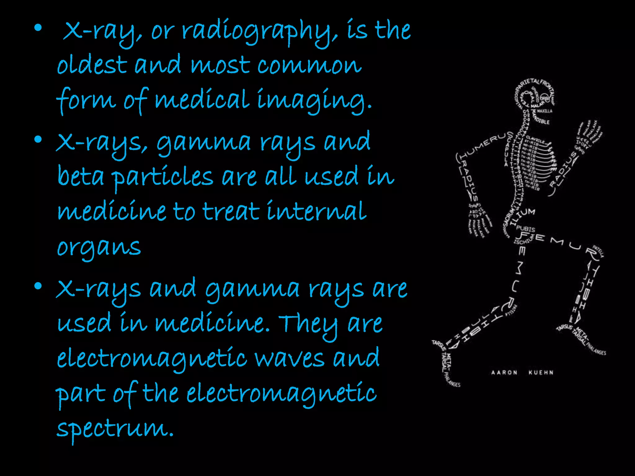 X-ray | PPT