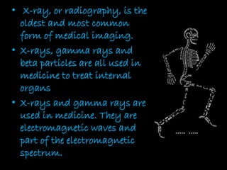 X-ray | PPT