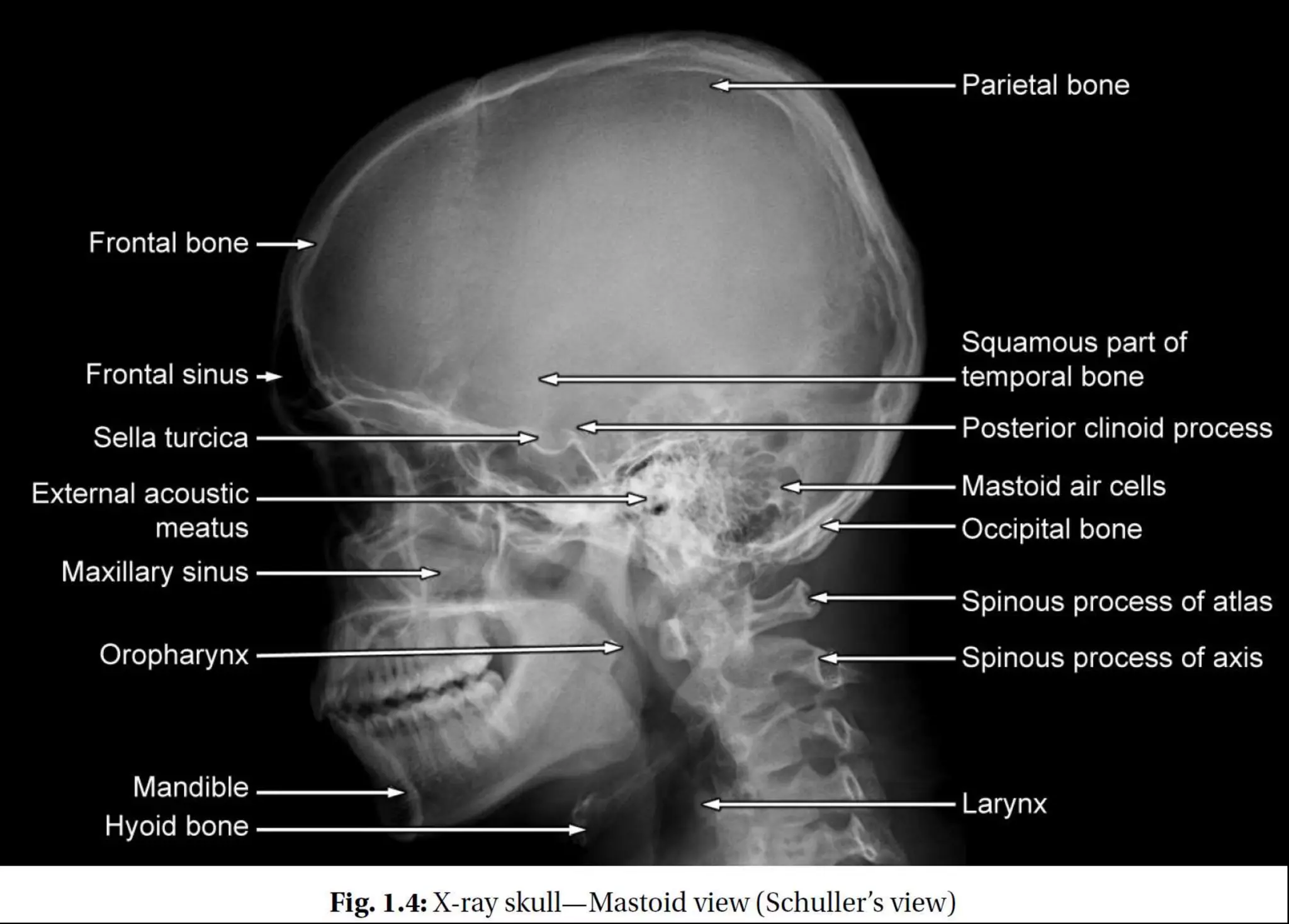X rays in ENT | PPTX