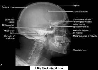 X rays in ENT | PPTX