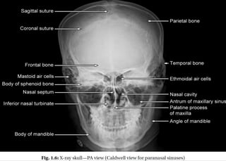 X rays in ENT | PPTX