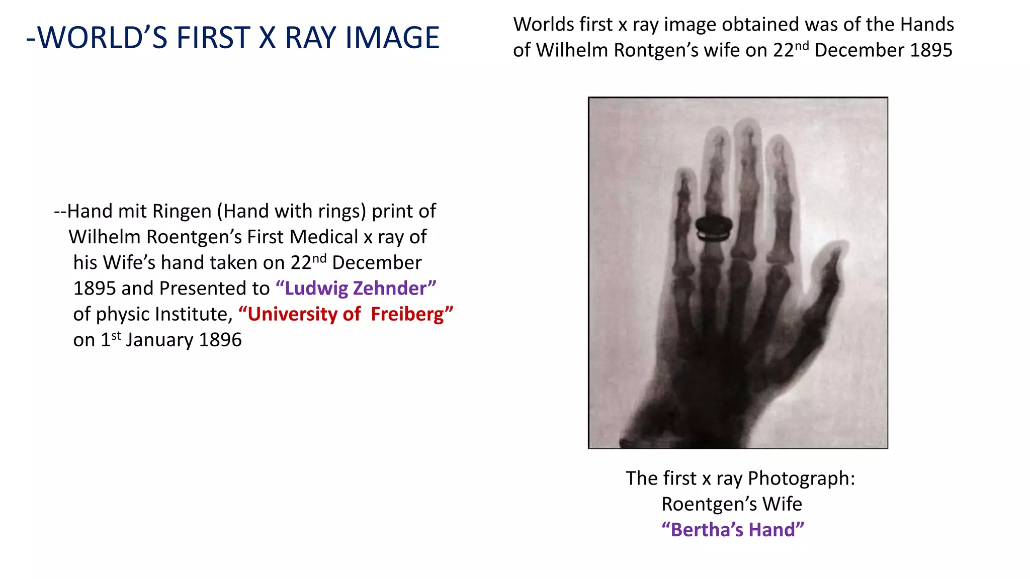 X ray | PPTX