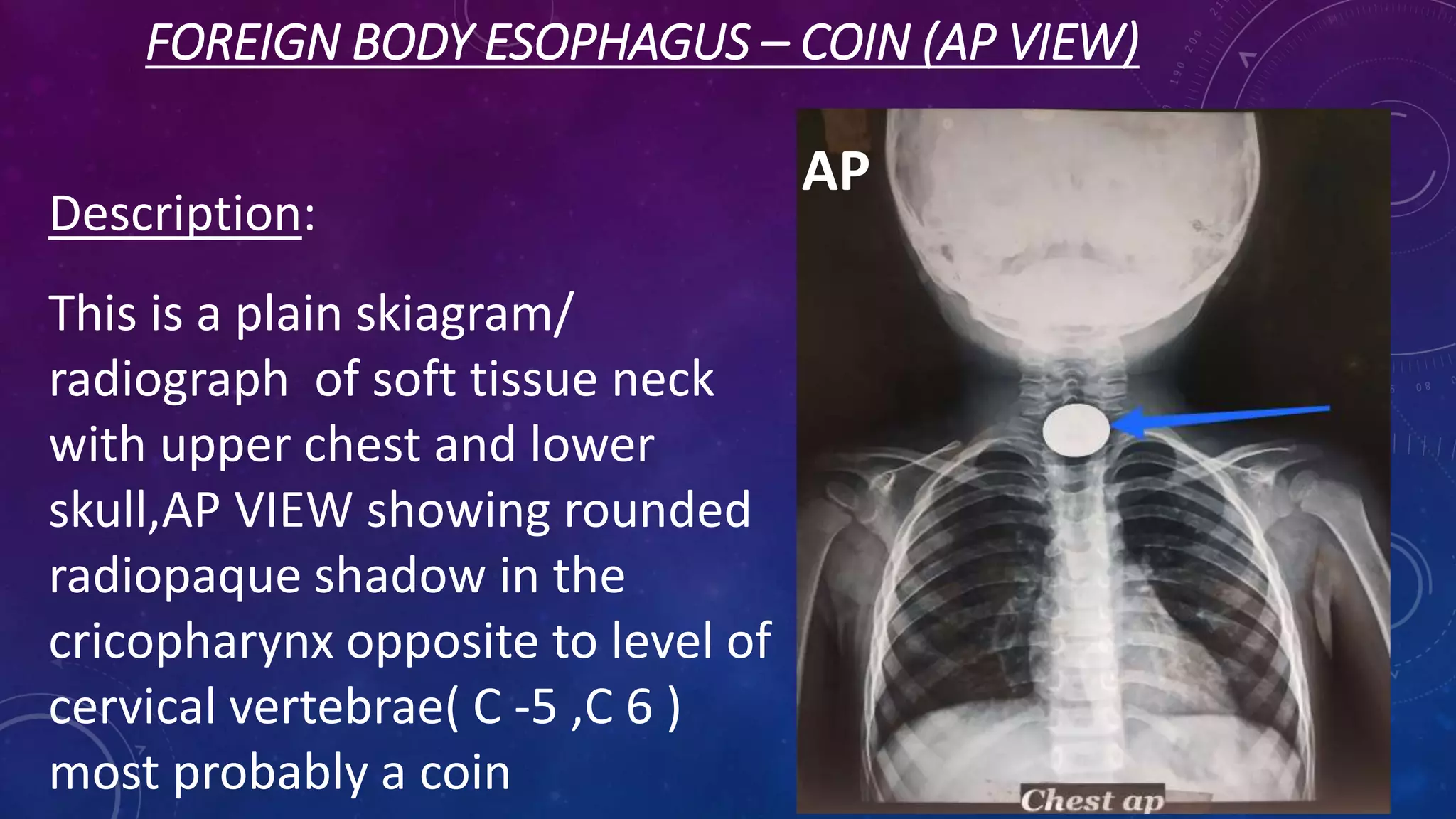 ENT radiology | PPTX