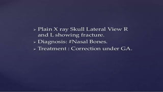 ENT radiology | PPTX