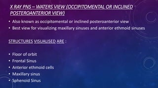 ENT radiology | PPTX