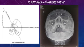 ENT radiology | PPTX