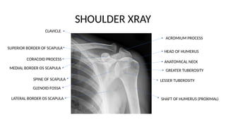 Slides of xray- detailed descriptions | PPTX