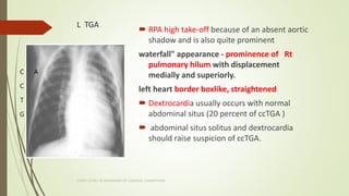 Waterfall Sign X Ray