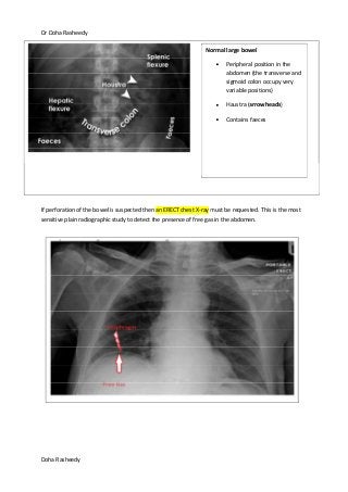 X ray abdomen | PDF