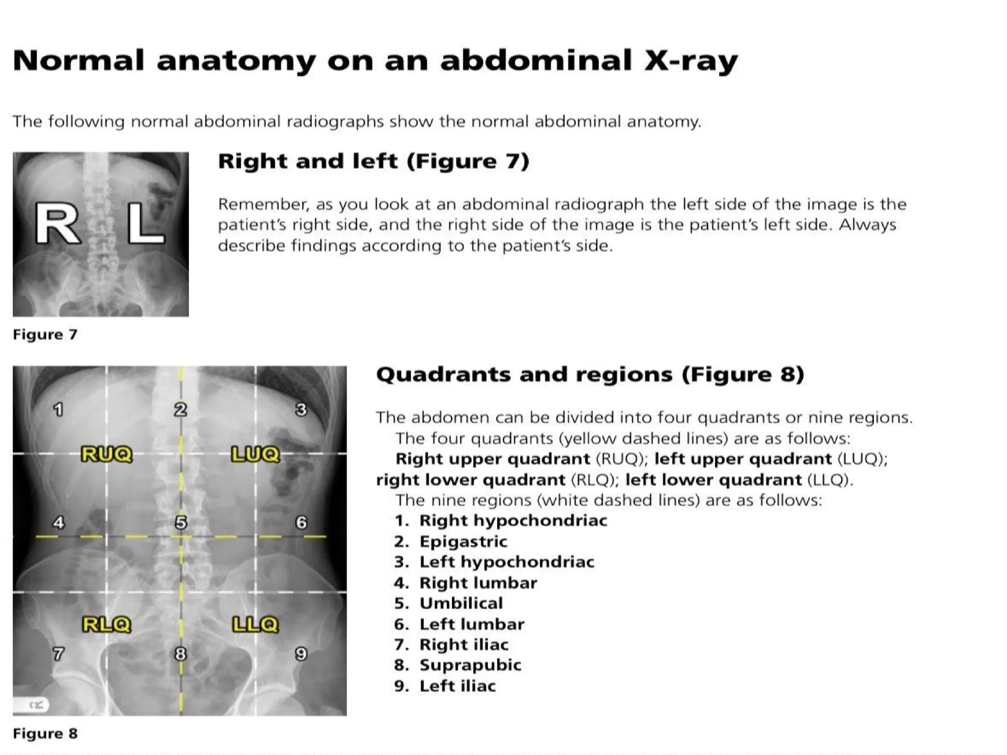 Xray Abdomen and associated pathologies PPT.pptx