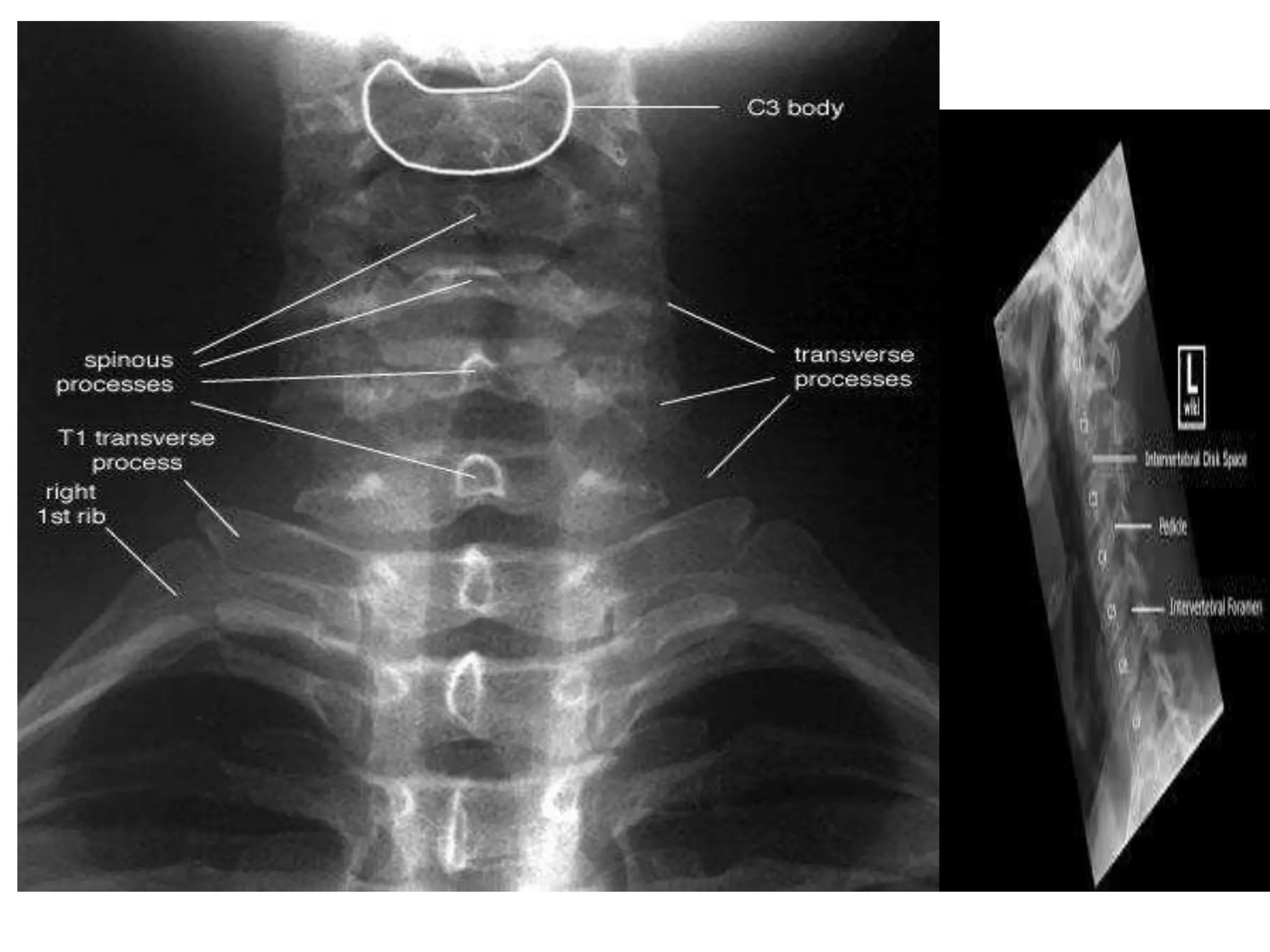 Xray anatomy image collection pk ppt | PPTX