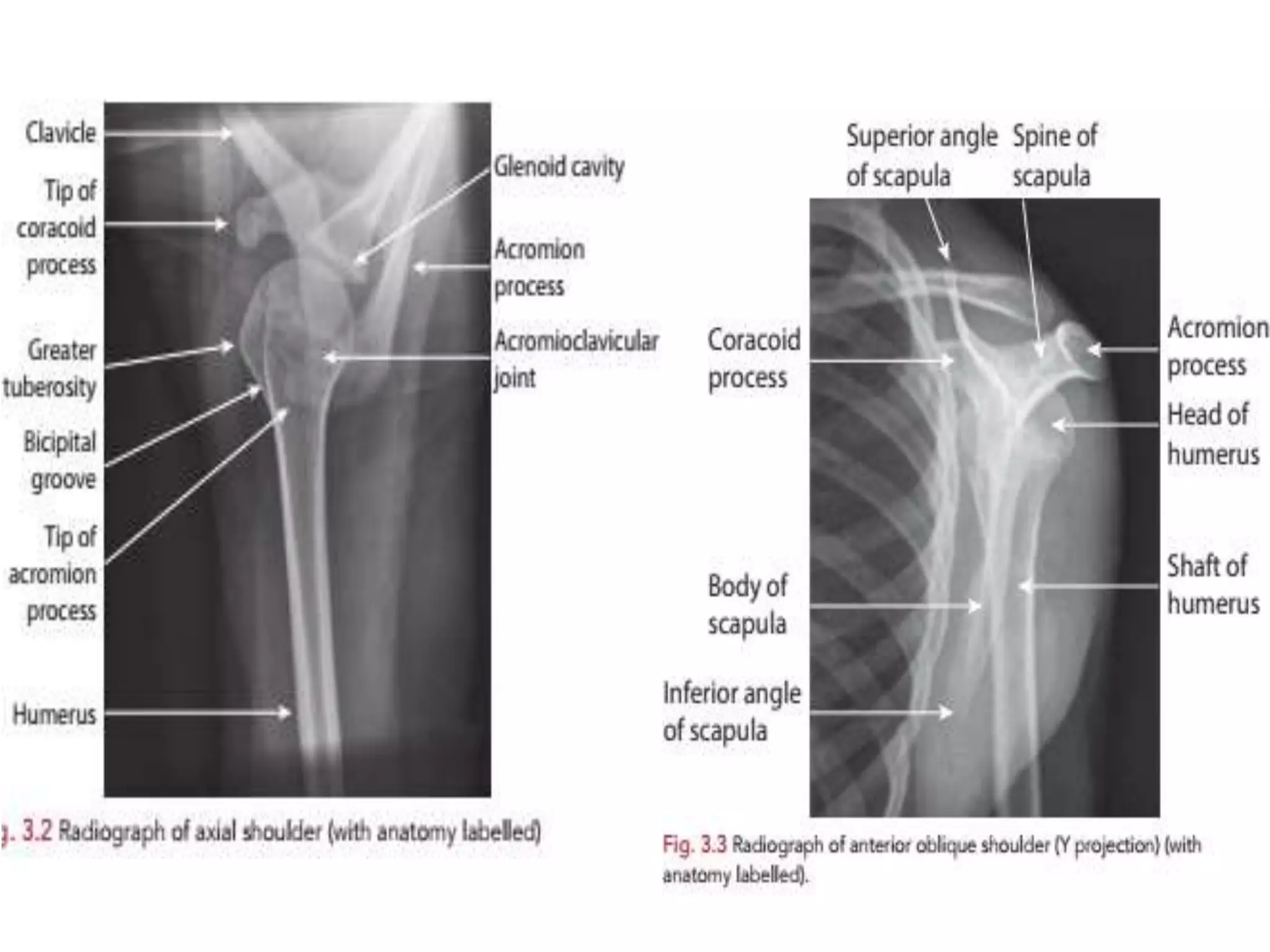 Xray anatomy image collection pk ppt | PPTX