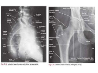 Sacrum Anatomy Xray