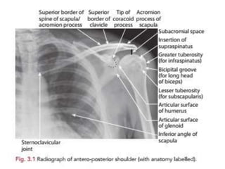 Scapula Anatomy Xray