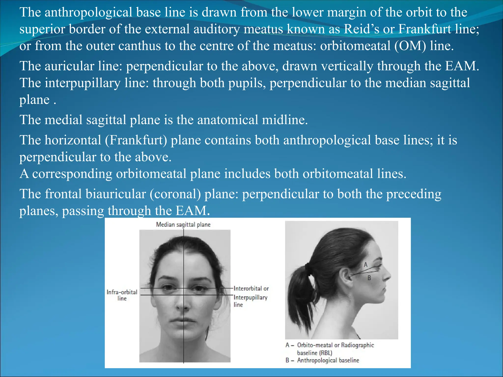 X RAY ANATOMY OF NORMAL SKULL.ppt heiejehehueh | PPT