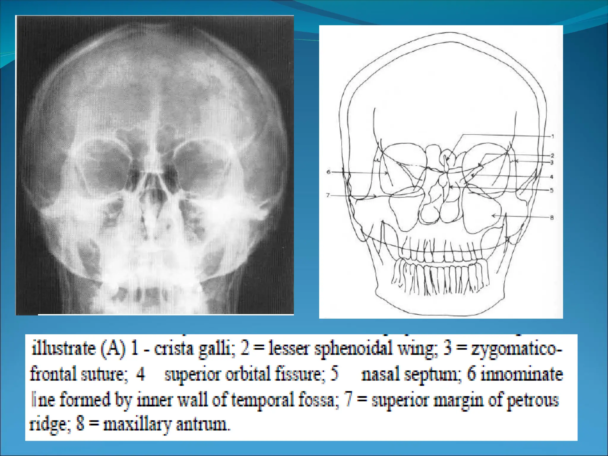 X RAY ANATOMY OF NORMAL SKULL.ppt heiejehehueh | PPT