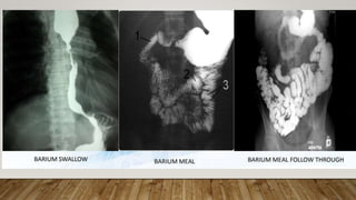 X-Ray and CT contrast agents | PPTX