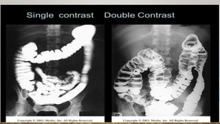 X-Ray and CT contrast agents | PPTX