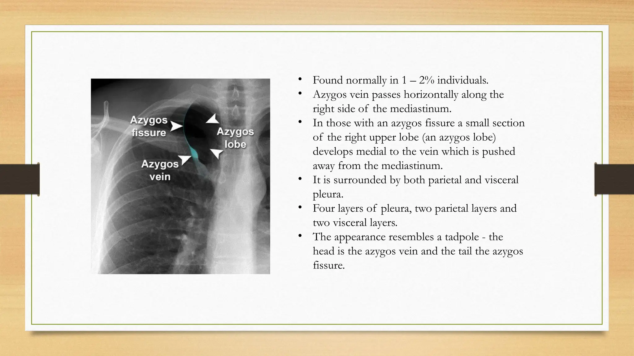 Xray and informed consent class by Dr Vaibhav | PPTX