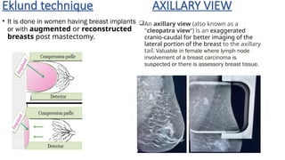 xray and sono MAMMOGRAPHY , brief explanation of technic | PPTX