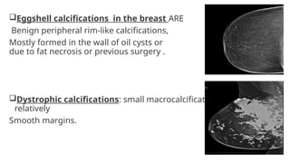 xray and sono MAMMOGRAPHY , brief explanation of technic | PPTX