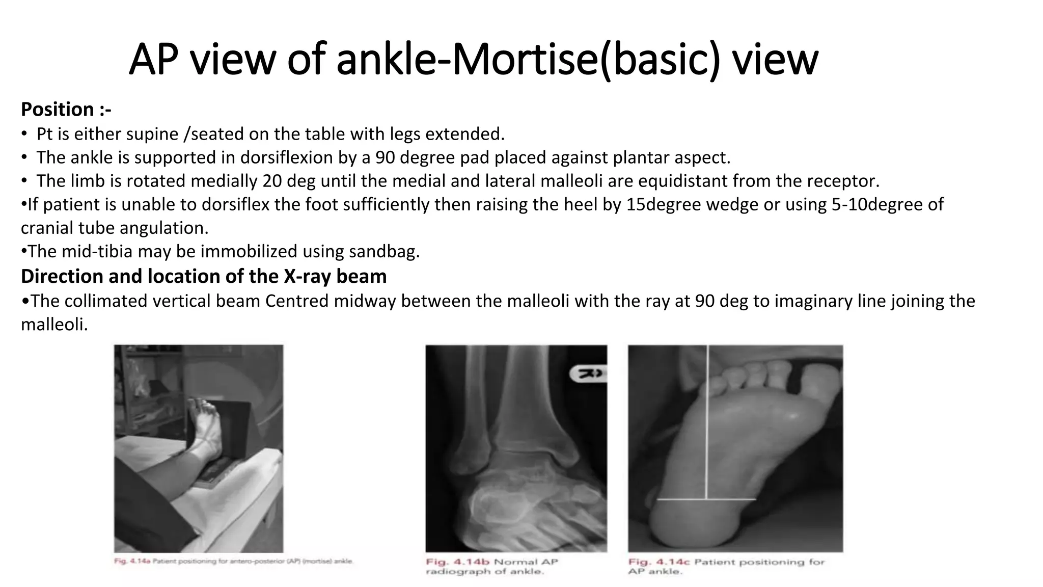 XRAY ANKLE POSITIONING.pptx