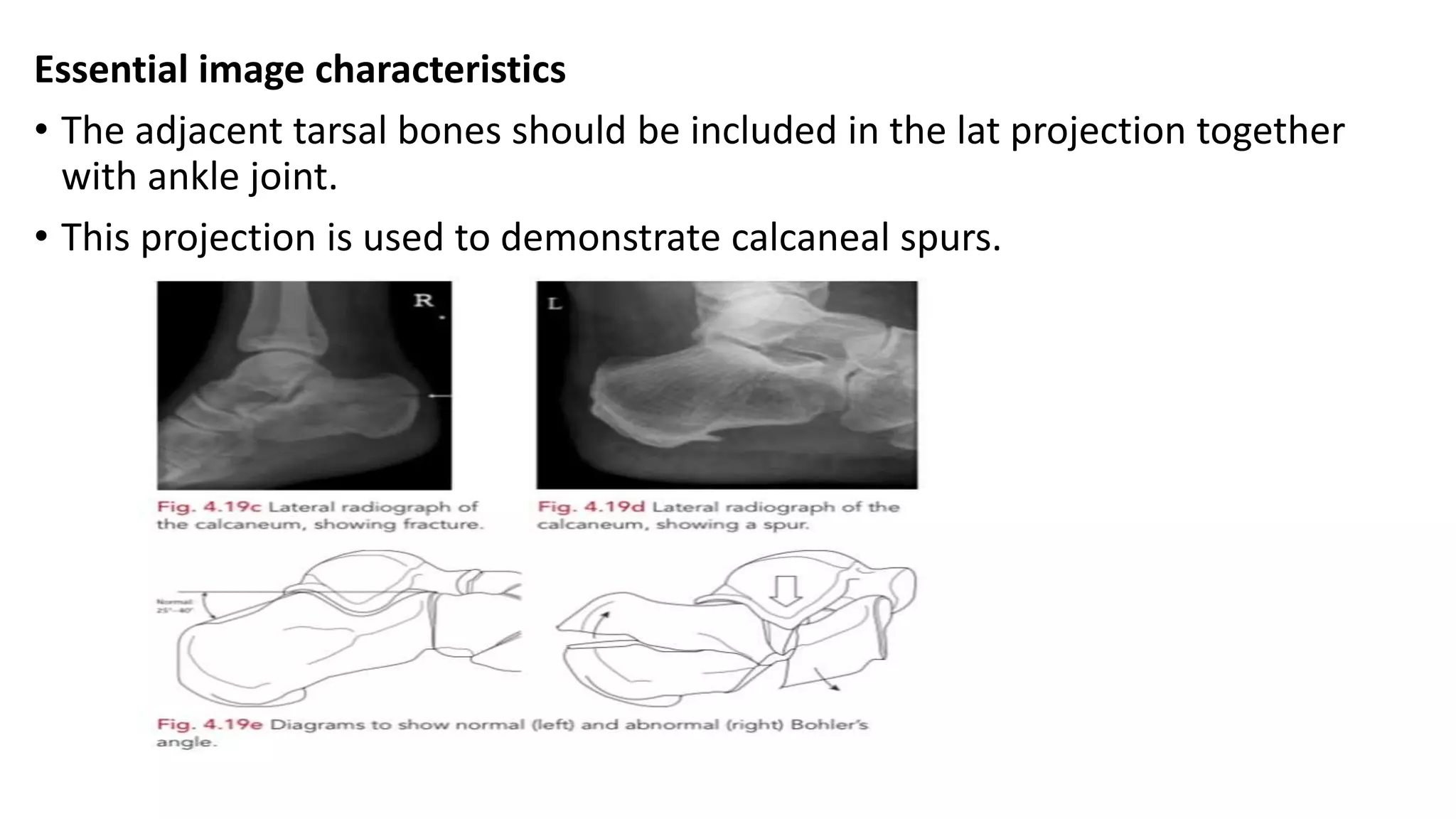 XRAY ANKLE POSITIONING.pptx