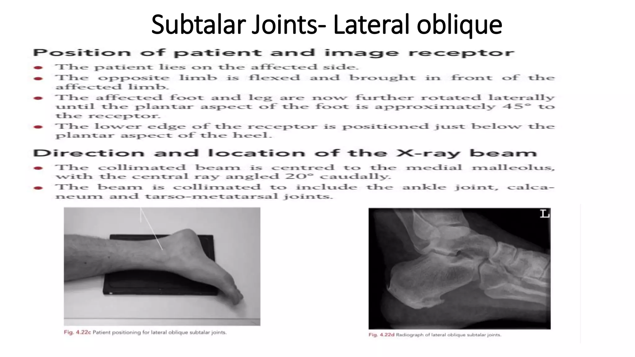 XRAY ANKLE POSITIONING.pptx