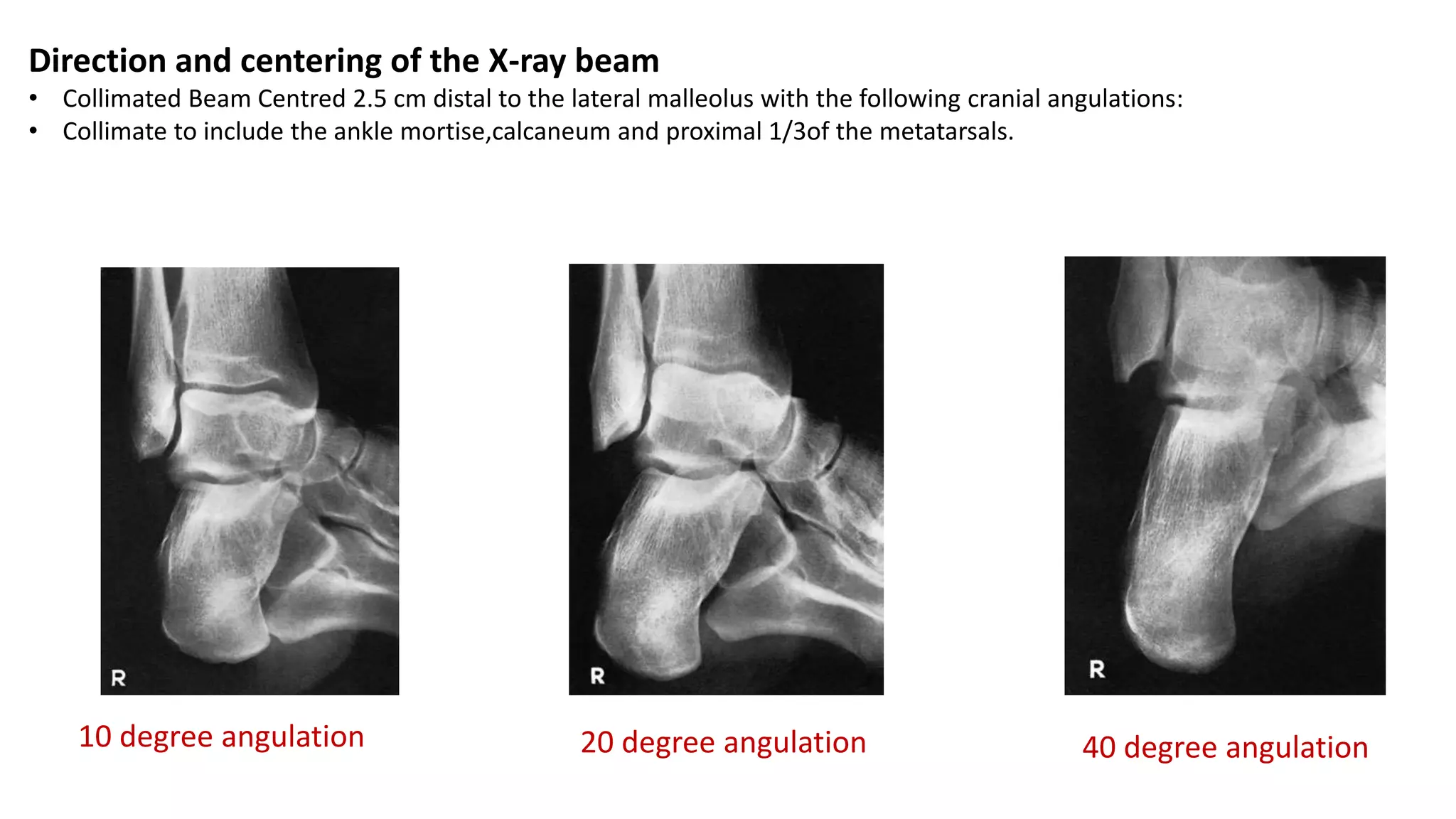 XRAY ANKLE POSITIONING.pptx