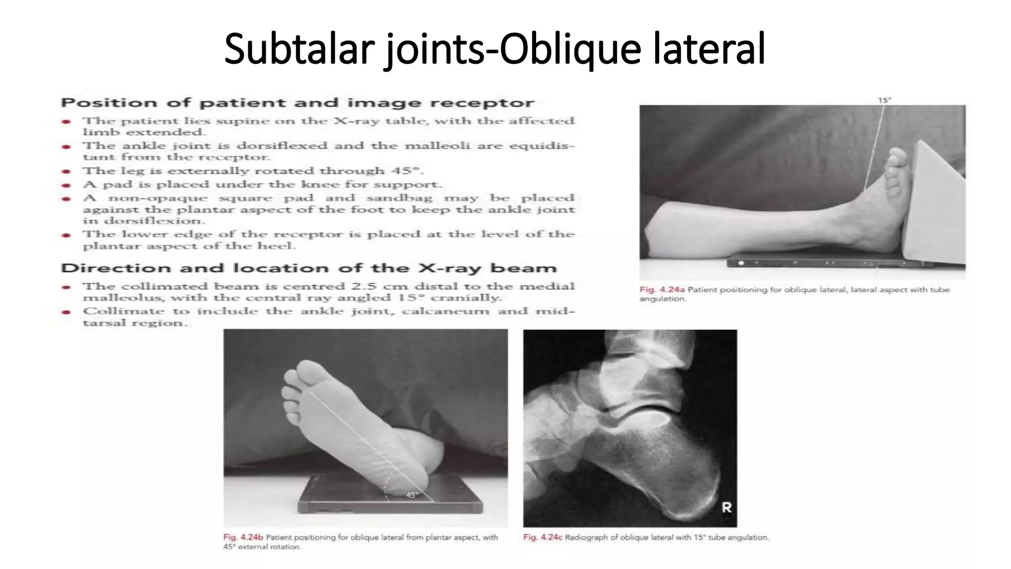 XRAY ANKLE POSITIONING.pptx