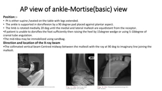 XRAY ANKLE POSITIONING.pptx